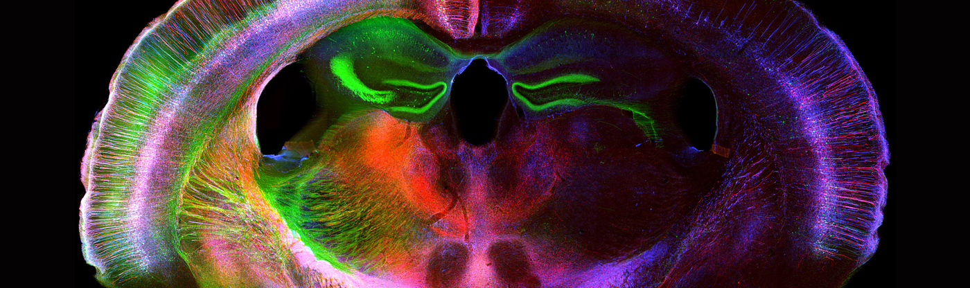 Dr. Dagdeviren to deliver a talk at the Center for Systems Neuroscience ...