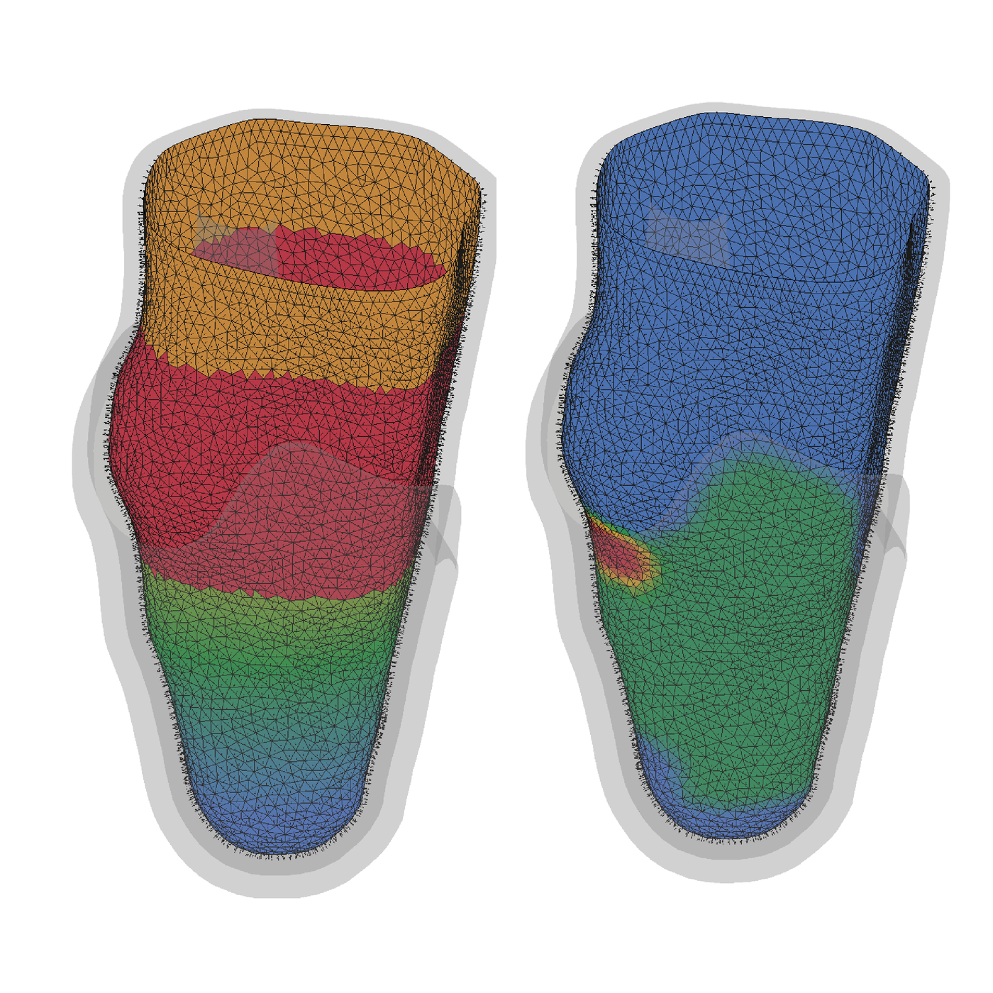 Overview ‹ Design and Clinical Evaluation of a Digital Transtibial ...