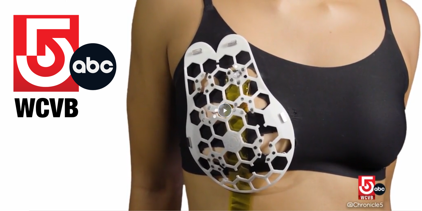 Conformable Decoders Featured on WCVB Chronicle — MIT Media Lab